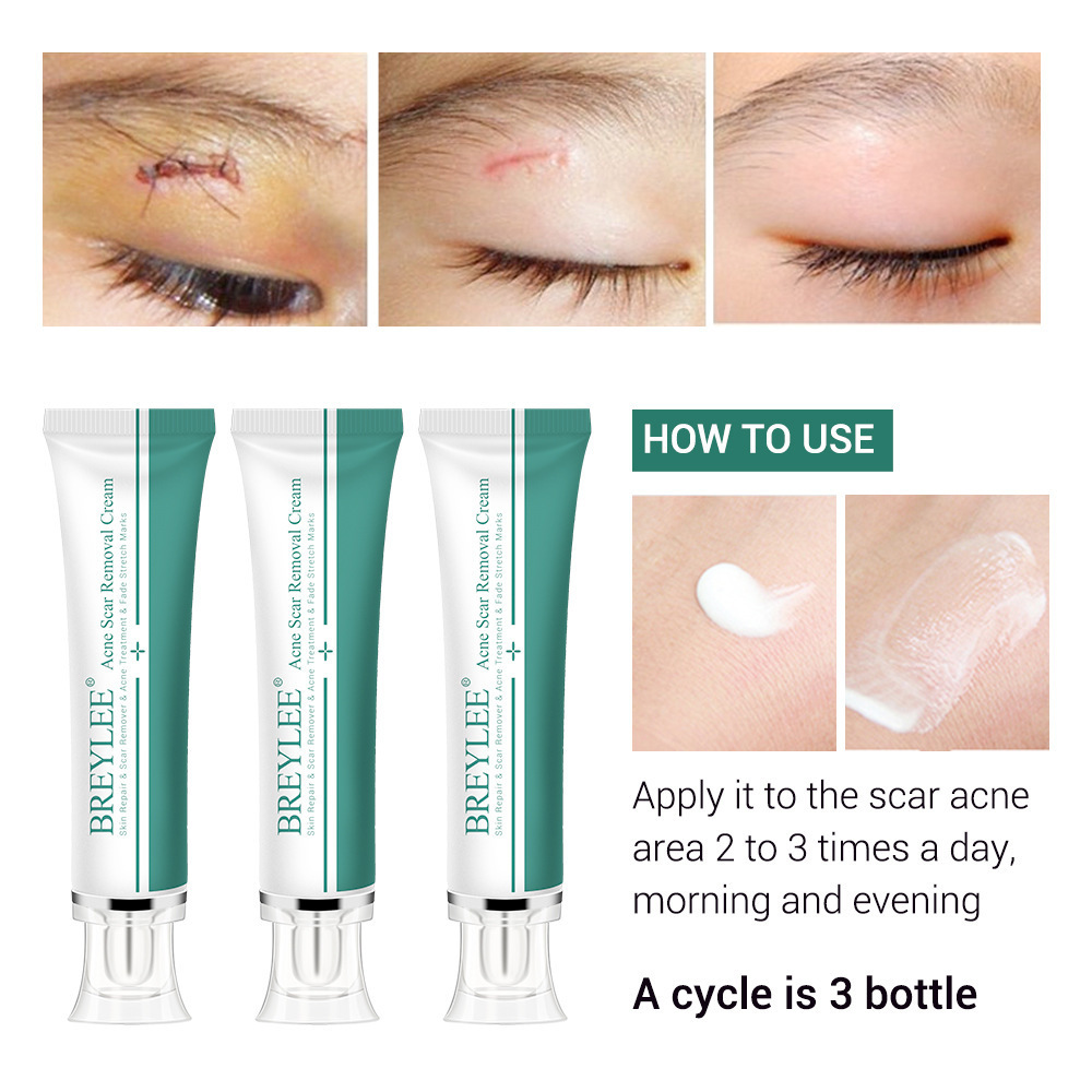 Skin Repair Face Cream – lgsproducts